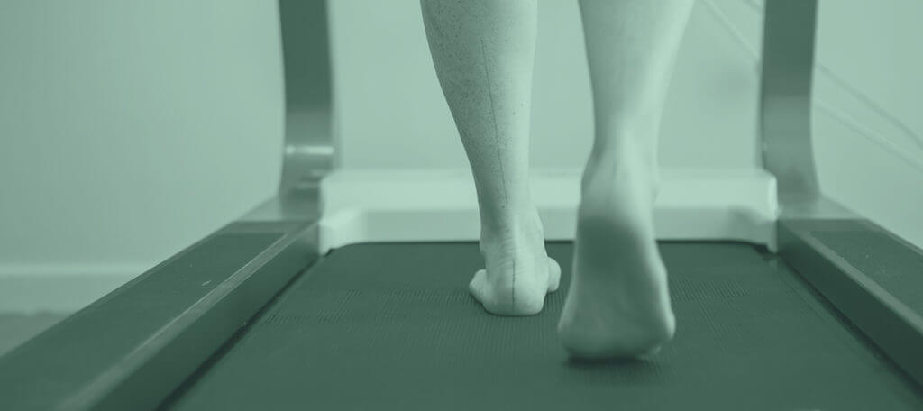 Gang - en loopanalyse - Voetnood